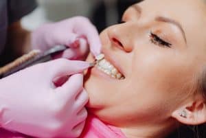 How to Identify Early Signs of Common Dental Problems – Arlis